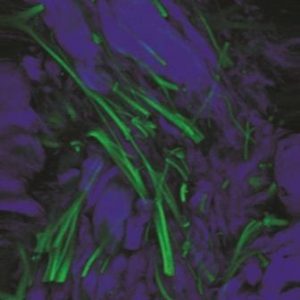 Using second-harmonic generation for a closer look at collagen