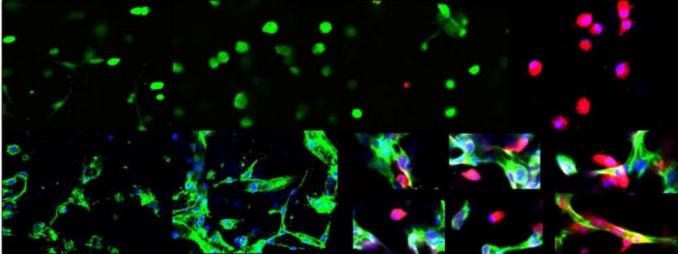 Biomimetic Hydrogels for Blood Vessel Development - Advanced Science News