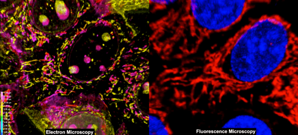 Combining Fluorescence and Electron Microscopy for 3D Cell Imaging ...