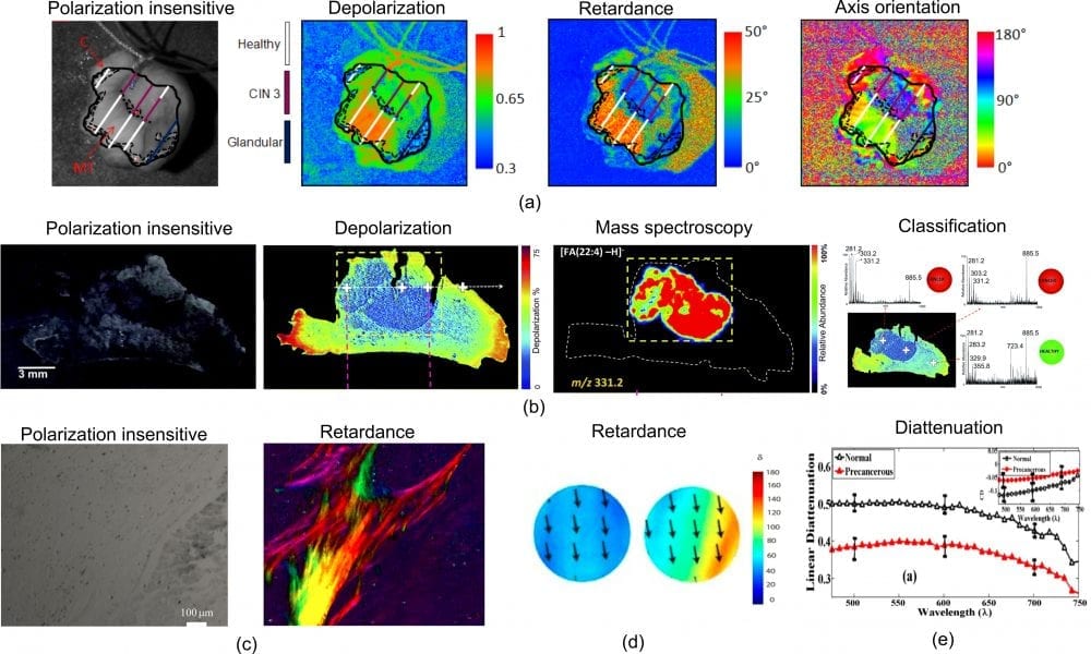 A Clear Picture of Polarimetric Imaging In 2017 - Advanced Science News