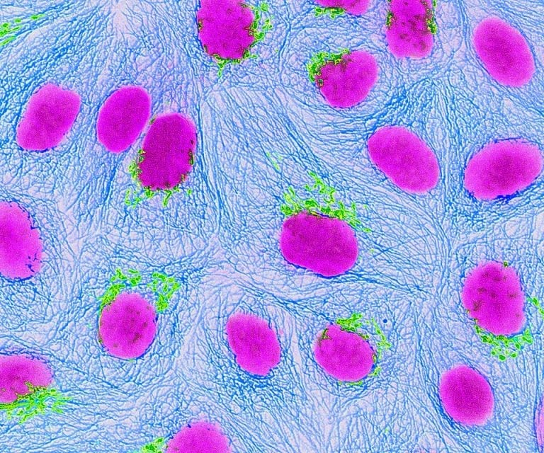 Manipulating Proteins inside Living Cells - Advanced Science News