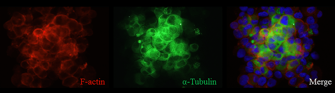 Cells in Microgravity - Advanced Science News