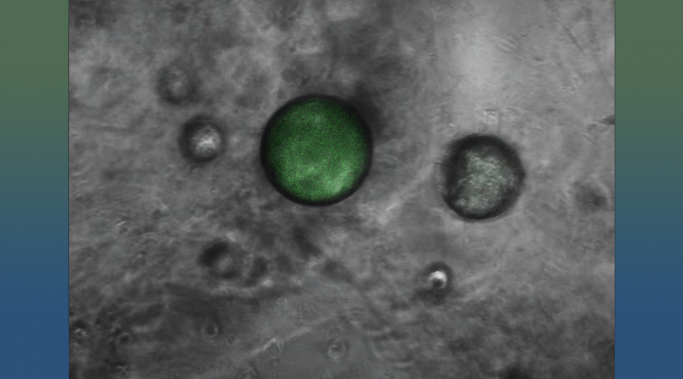 Synthetic Cells Gain the Upper Hand Against Cancer - Advanced Science News