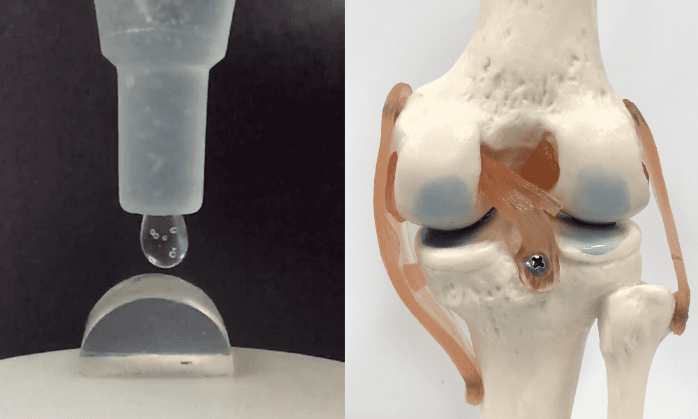 New Ways to Structure Clinically Approved Hydrogels [Video] - Advanced ...