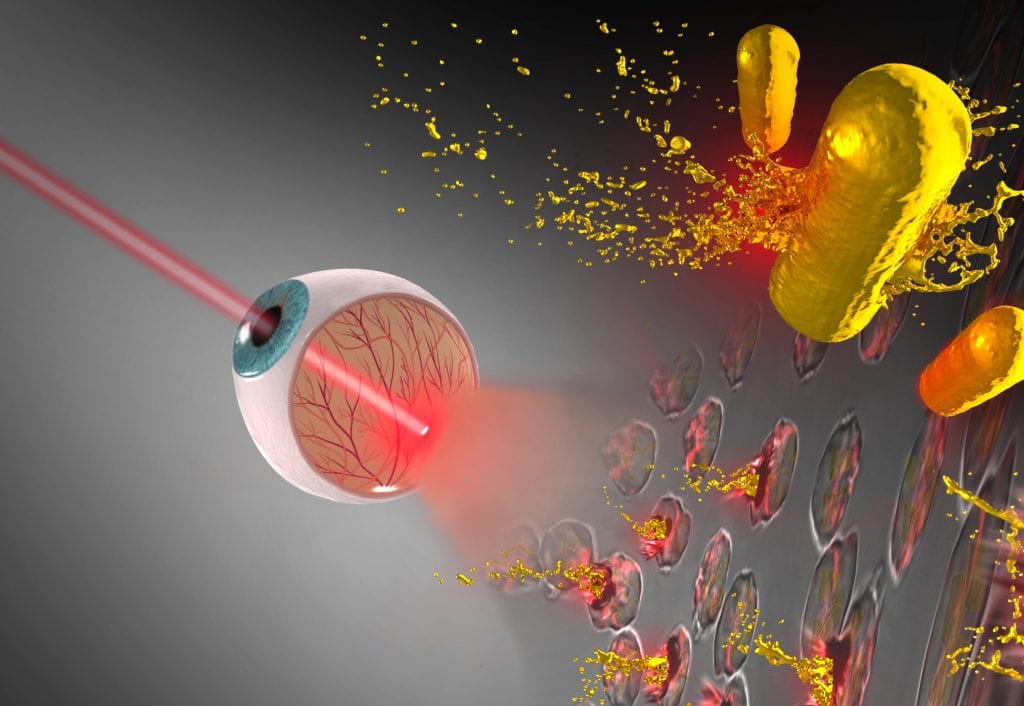 Lasering in on Retinoblastoma - Advanced Science News