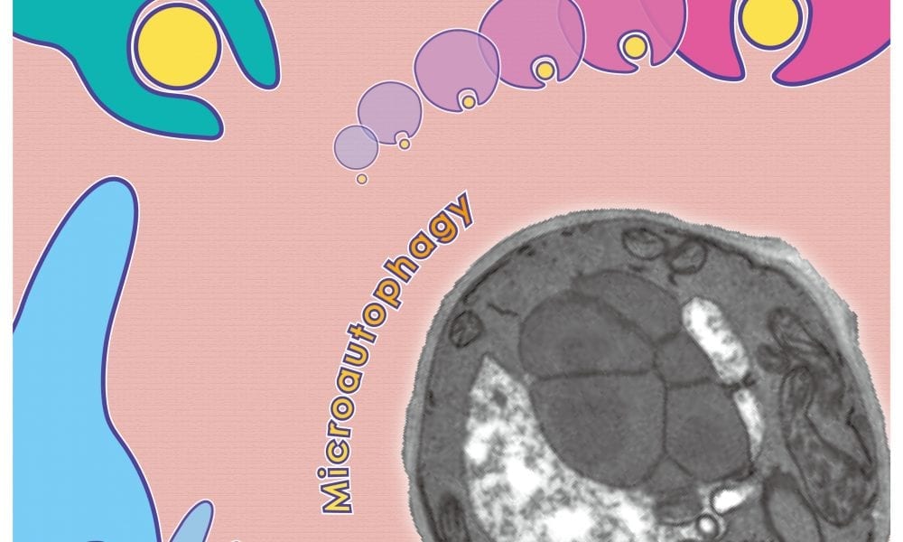 Disassembly at the Micro-Scale: Classification of Three Distinct Types ...