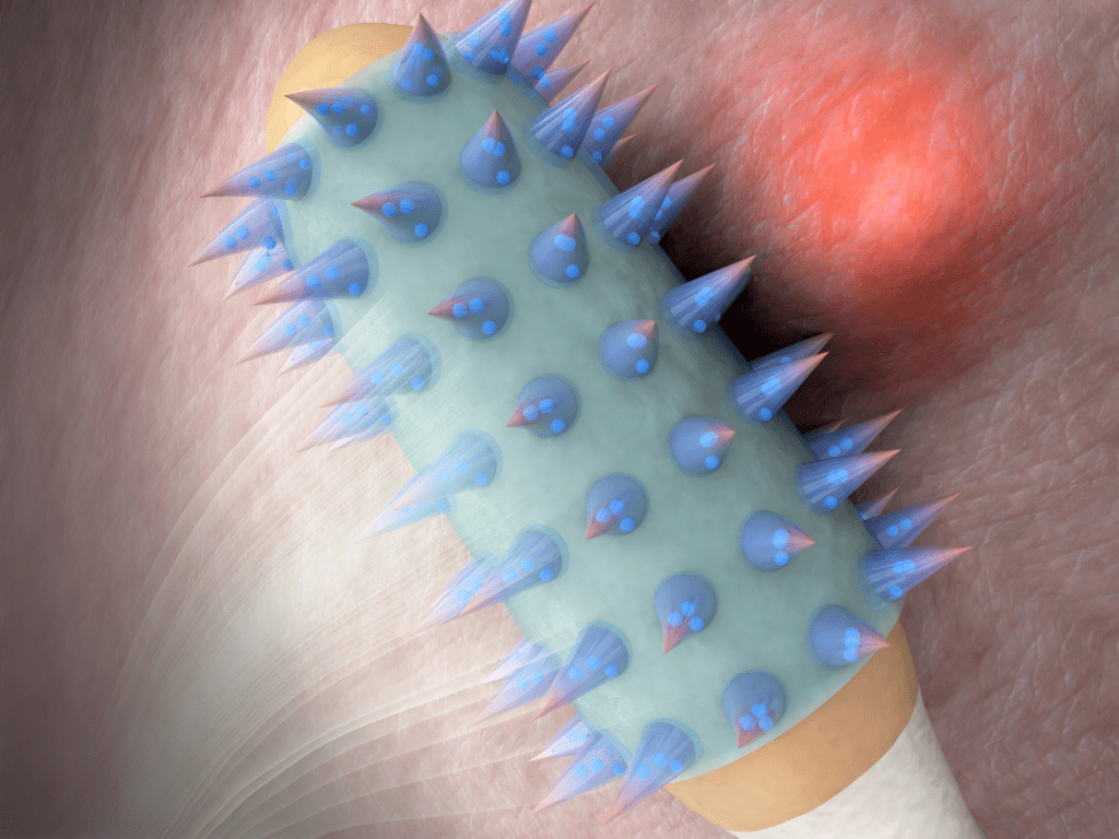 Annihilating Acne: A New Approach - Advanced Science News