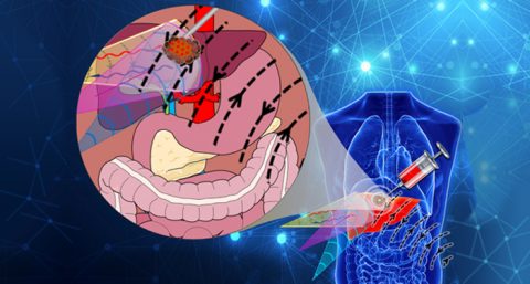 Trackable Smart Drug Delivery System for Cancer Treatment - Advanced ...