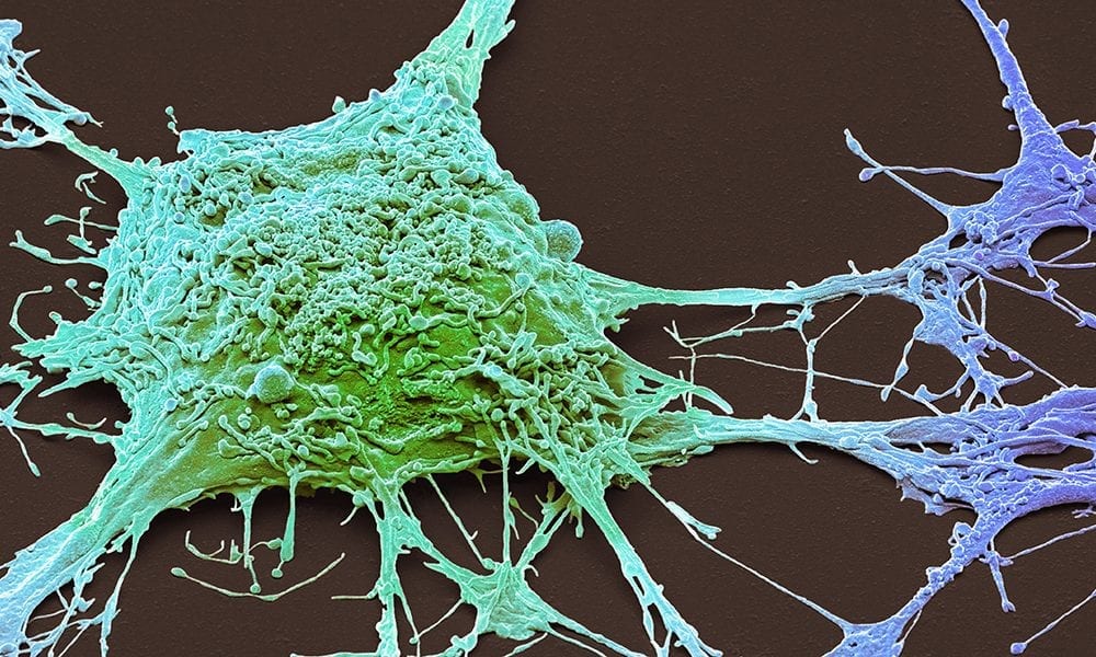 Business as usual … on the edge: Neuronal outgrowths do their own ...