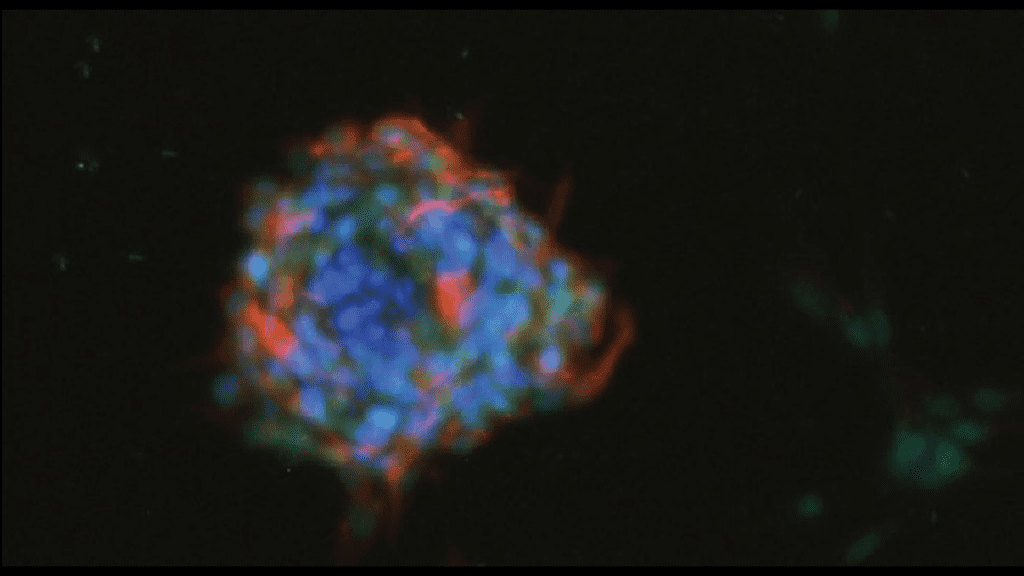 Speeding up neuron growth with a phage - Advanced Science News