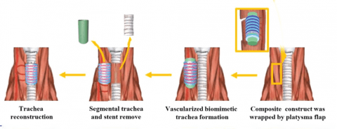 Treating tracheal defects using flexible polymeric biomaterials ...