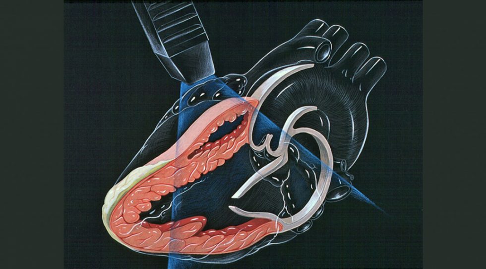 Insights into heart development with 3D bioprinting - Advanced Science News
