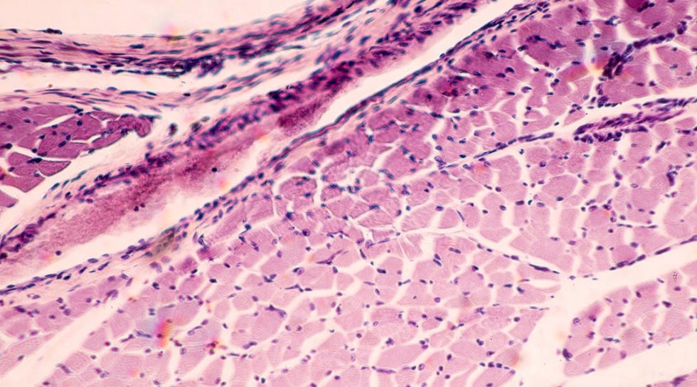 Bioengineered muscle fibers help regrow damaged tissue - Advanced ...