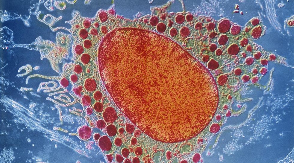 Autoimmune diseases captured in a library of genetic markers - Advanced ...