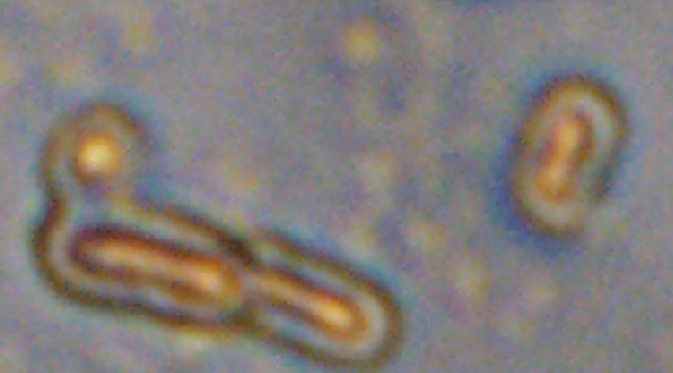 Bacteria provide heart attack treatment - Advanced Science News