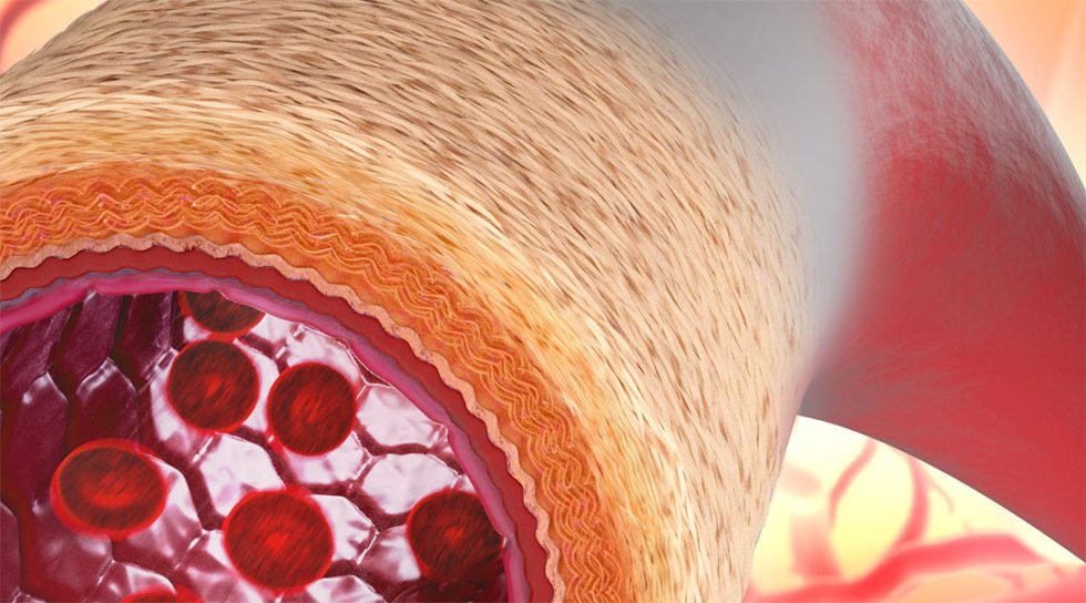 New artificial blood vessel integrates into the body - Advanced Science ...