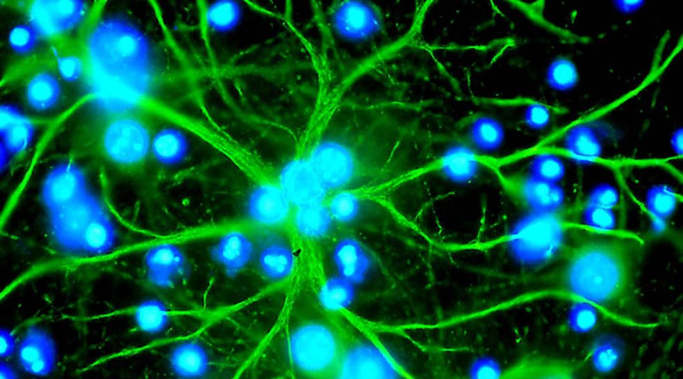 Uncovering a new language in the brain - Advanced Science News