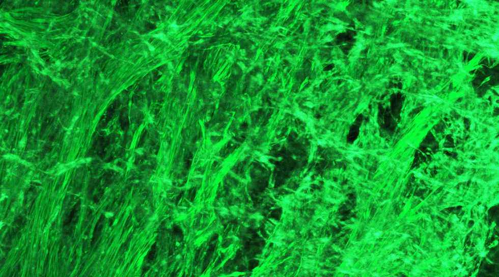 Decisive push brings the first artificial intestine closer - Advanced ...