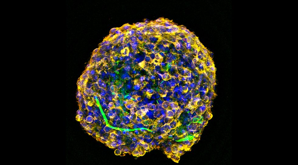 3D cell spheroid promotes spinal cord repair in mice - Advanced Science ...