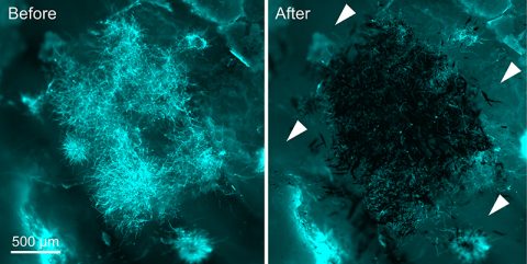 Microrobots kill fungal infections in just ten minutes - Advanced ...