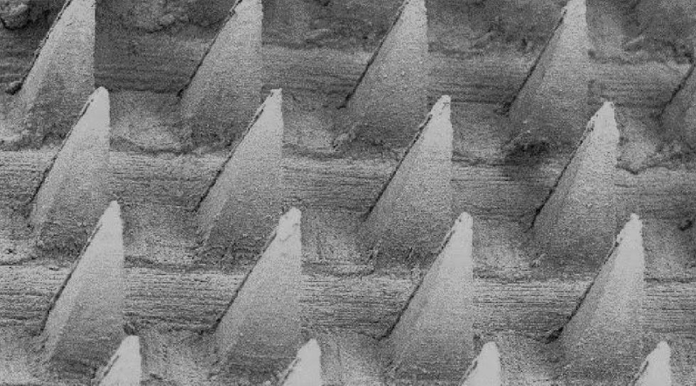 Making long-term microneedle therapies safer - Advanced Science News