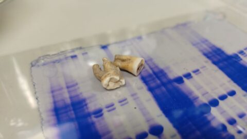 Centuries-old antibodies recovered from ancient teeth - Advanced ...