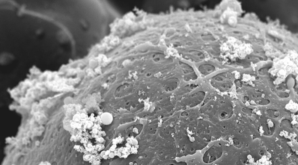 Fertility treatment finds gentler way to handle embryos using magnetic ...