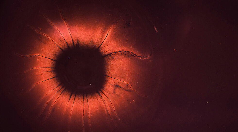 Study finds zombie cells may play a role in aging - Advanced Science News