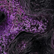 Team builds first living robots using frog stem cells - Advanced Science News