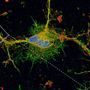 Team builds first living robots using frog stem cells - Advanced ...